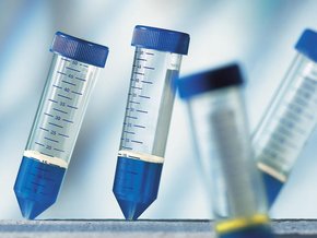 Greiner Bio-One | 做出改变